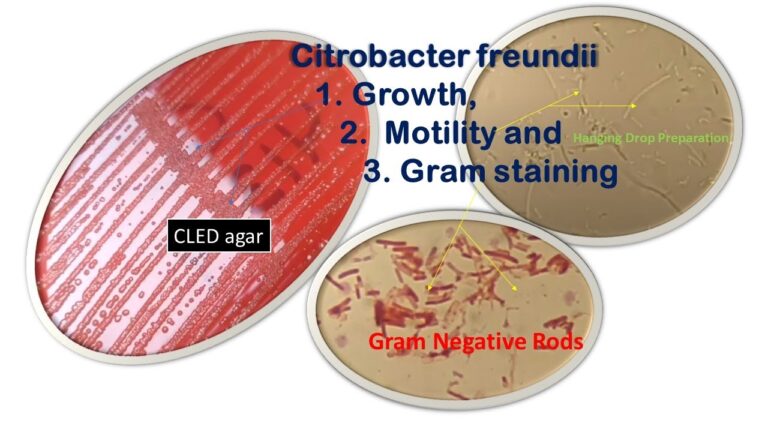 Citrobacter freundii growth, Motility and Gram staining - 今さら聞けない。もっと知り ...
